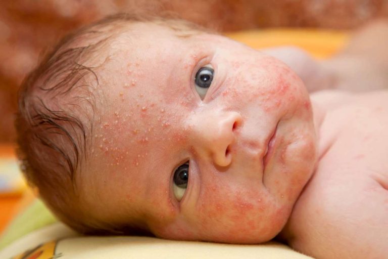 Kids Vaccination: What Should Parents Know?